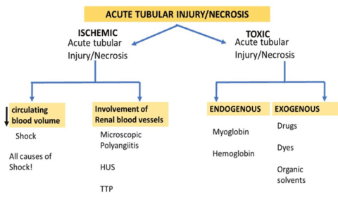 CDI Tips: Acute Tubular Necrosis (ATN) - e4health