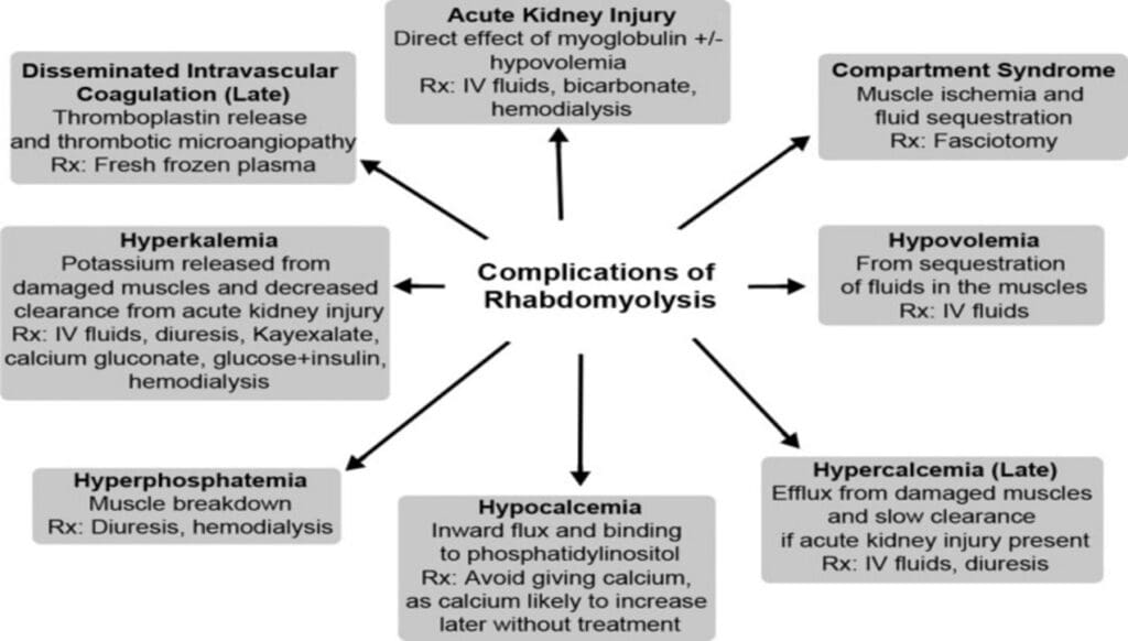 CDI Tips & Friendly Reminders: Rhabdomyolysis